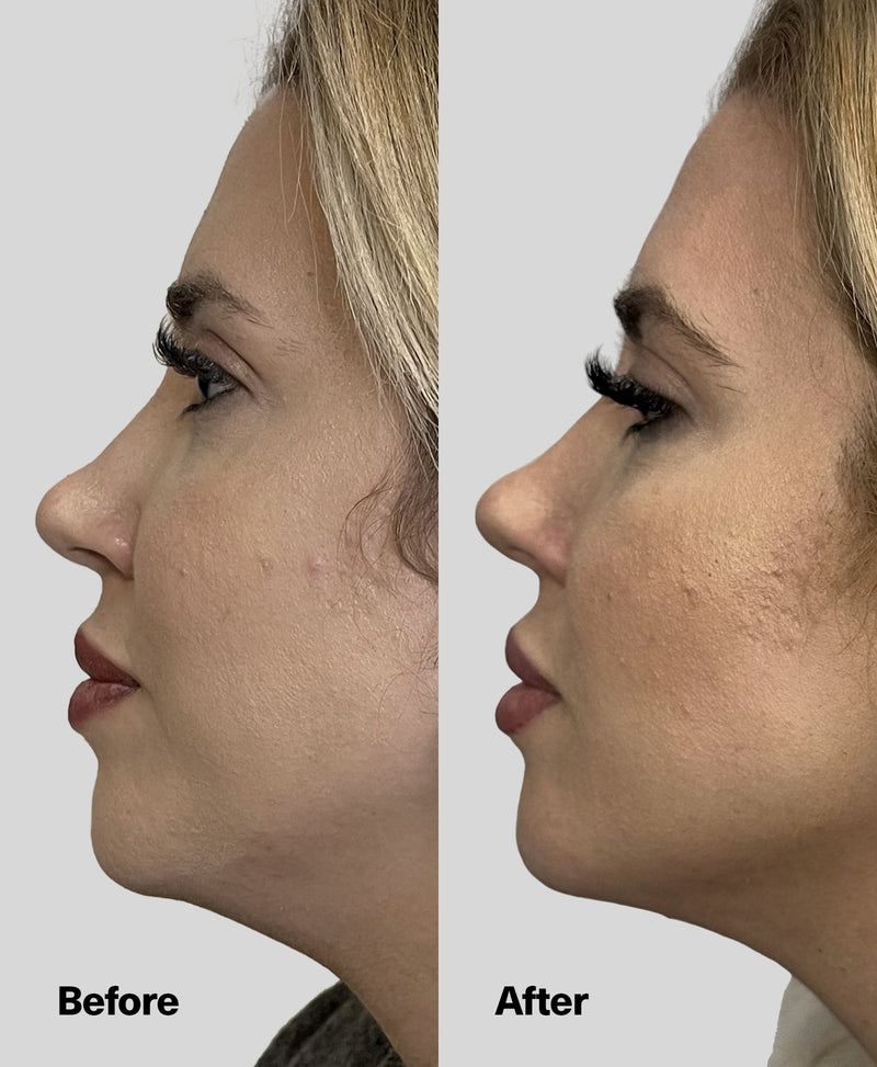 ShapeShift - V line Jaw Defining Serum